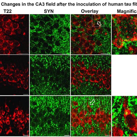 Colocalization Of The Presynaptic Protein Synaptophysin Syn Green