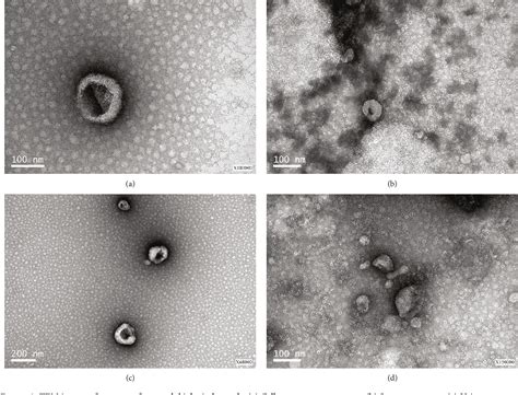 Figure 1 From Exploring Purification Methods Of Exosomes From Different