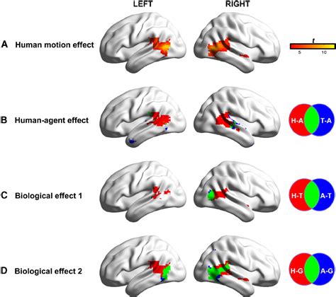 Medial Temporal Gyrus