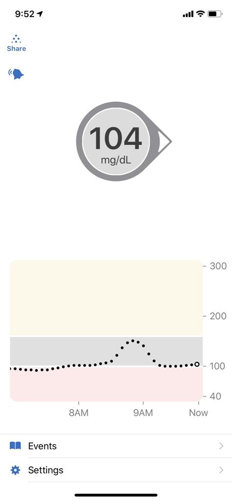 Dexcom Readings Rise Fall During And Posy Shower More In Comments R
