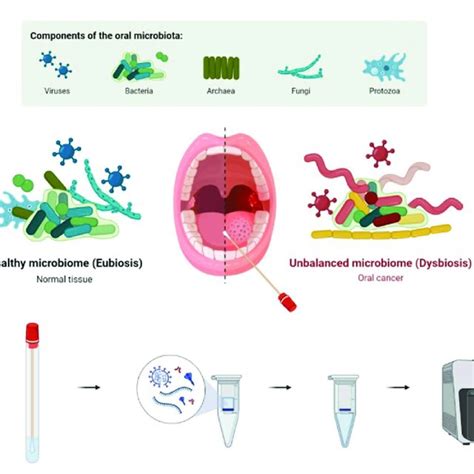Existence And Manifestation Of The Oral Microbiota In Oscc Intratumor