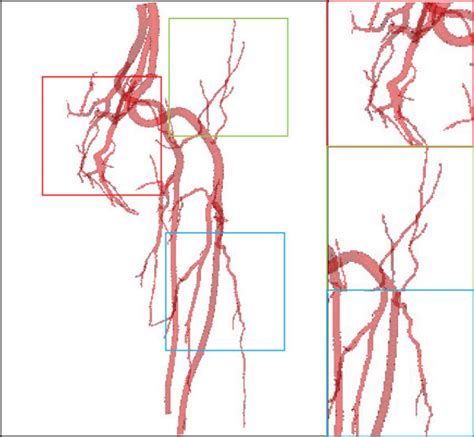 Medical Image Segmentation Results Tested In The Dataset Of Leg Artery