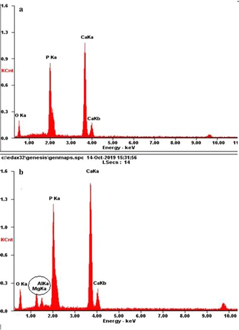 Edx Analysis Of Granules A β Tcp Granules B β Tcp Granule 10 Ldh