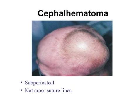 Assessment Of Normal Neonate Pptx