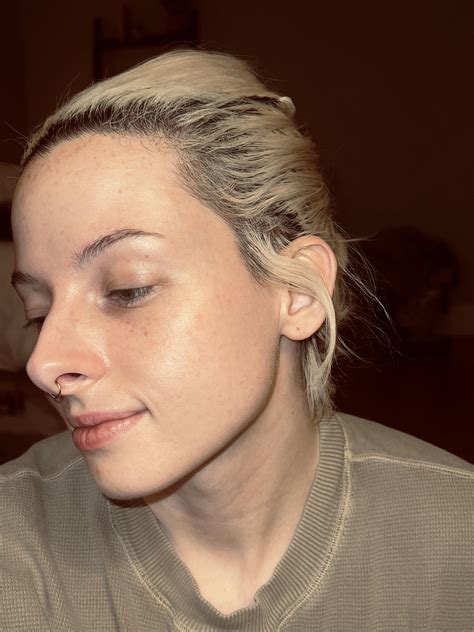 My Skin Looks The Best It Ever Has Right Now Swipe To See What It