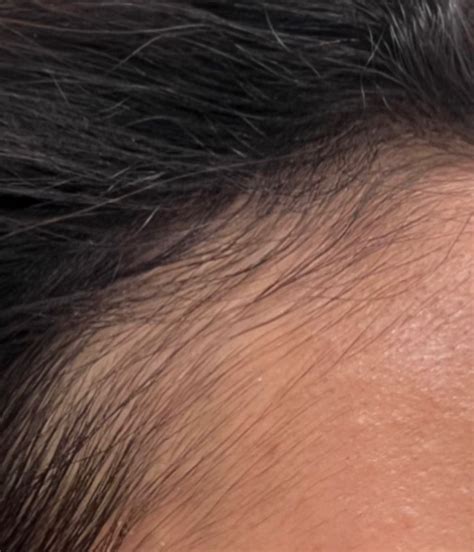 Hair Density Serum Monpure