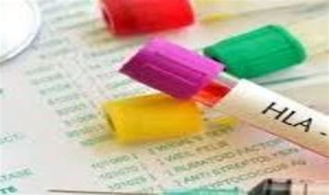 What Is The Cost Of HLA Typing Test In India