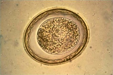 Parasitology Exam Identification Flashcards Quizlet