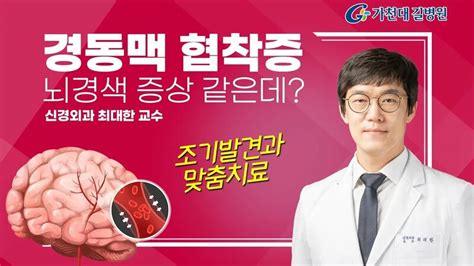 경동맥 협착증 치료 뇌경색 전조증상 주의 Смотреть онлайн в поиске Яндекса по Видео