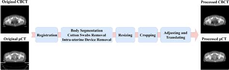 Figure 2 From Cbct To Ct Synthesis For Cervical Cancer Adaptive