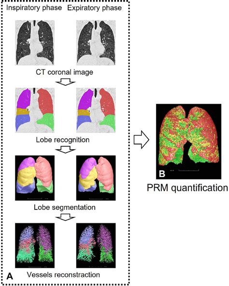 Schematic Diagram Of Parameter Measurement In Biphasic Quantitative Ct