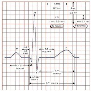 PDF Efficient Electrocardiogram ECG Lossy Compression Scheme