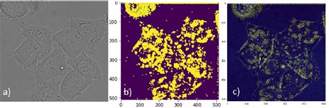 Figure 8 From Deep Learning Based Bio Medical Image Segmentation Using