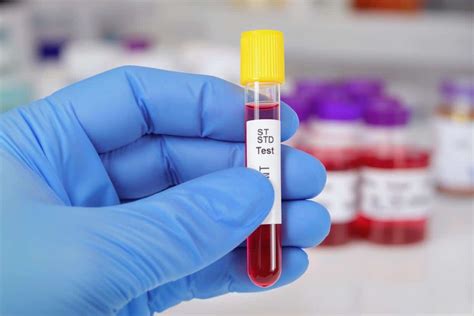 Std Screening — Bimc Hospital Bali