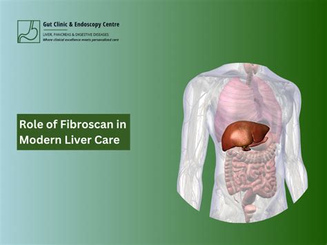 The Role Of Fibroscan In Modern Liver Care