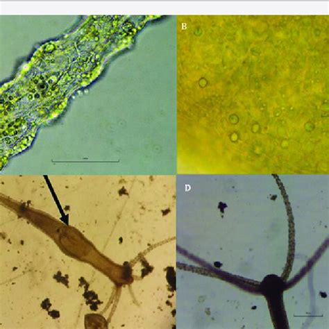 Photomicrographs Of Hydra Vulgaris Taken With A Nikon Eclipse Optical Download Scientific