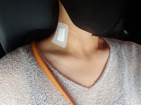 목디스크 신경차단술 스테로이드주사 한달후기 네이버 블로그