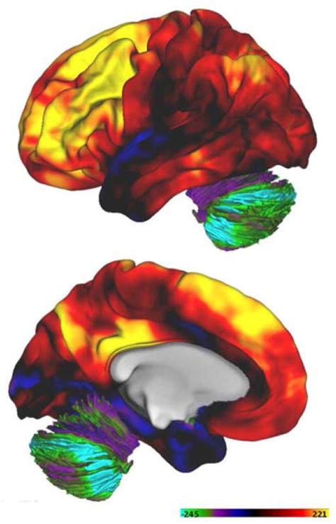 Aerobic Glycolysis In The Human Brain Is Associated With Development
