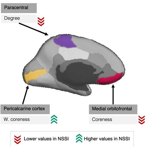 Associations Between Graph Based Measures Of Regional Functional