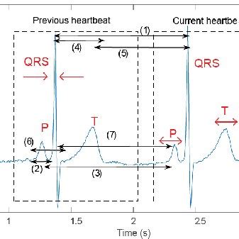 An Annotated ECG Waveform Highlighting ECG Wave Components And The Download Scientific Diagram