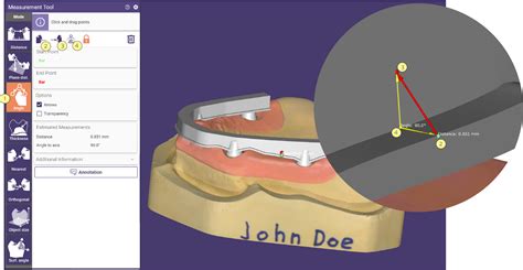 Measurement Tool Exocad