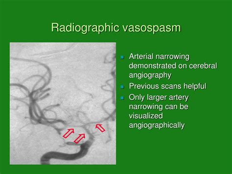 Ppt Aneurysm Clinical Presentation Diagnosis And Anaesthetic