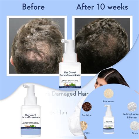 Nourish Growth Diva Curls Products Hair Products For Dry Hair Leave In