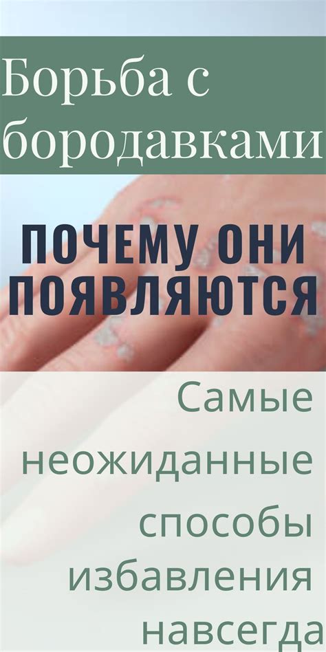 Бородавки почему появляются и как их лечить Turbo Tips Beauty