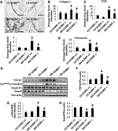 Endothelial Mineralocorticoid Receptor Deletion Prevents Diet Induced
