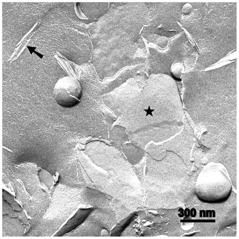 Freeze Fracture Electron Micrograph Of Lps From S Enterica Sv