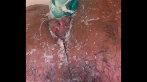 Prolapse Anal Fucking By Tony Tunnels Xxx Mobile Porno Videos