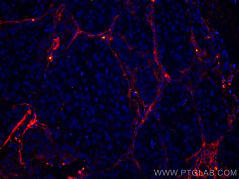 Col6a1 Antibody Cl594 66824 Proteintech 武汉三鹰生物技术有限公司