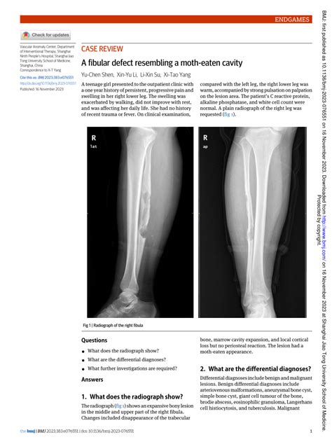 Pdf Case Review A Fibular Defect Resembling A Moth Eaten Cavity