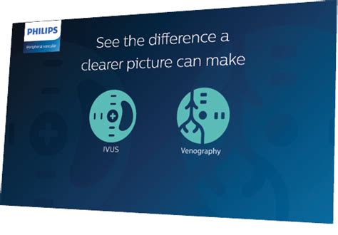 Venous Ivus Intravascular Ultrasound Philips Healthcare
