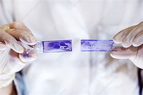 Stained Microscope Slides Stock Image F024 5620 Science Photo Library