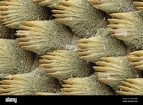 Leech Body Surface Coloured Scanning Electron Micrograph Sem Of The