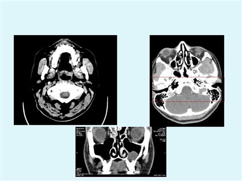 Технологии проведения КТ исследований с внутривенным контрастированием презентация онлайн