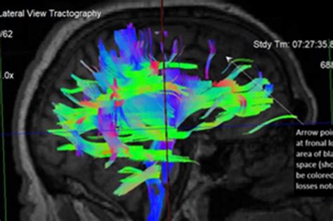 dti diffusion tensor imaging life sciences imaging