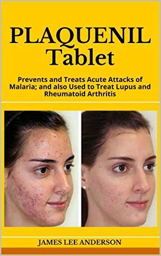 Plaquenil Tablet Prevents And Treats Acute Attacks Of Malaria And