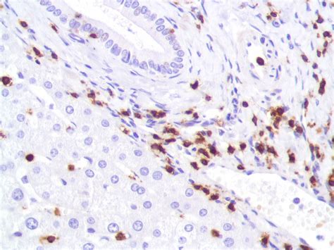 Lymphocyte Marker Antibody Duo Cd3 Cd19 Ihcicc Arg30127 Arigo