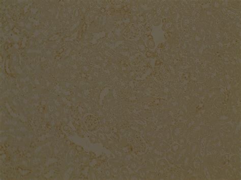 How To Reduce Background In Ihc Researchgate