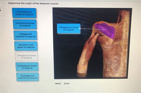 Solved Determine The Origin Of The Featured Muscle Supraspinous Fossa Of 1 Answer
