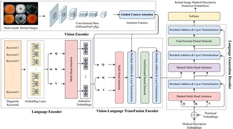[논문 리뷰] Gcs M3vlt Guided Context Self Attention Based Multi Modal Medical Vision Language