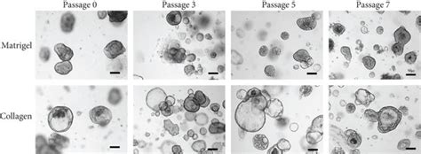 Comparison Of Growing Human Derived Colon Organoids In Matrigel And In