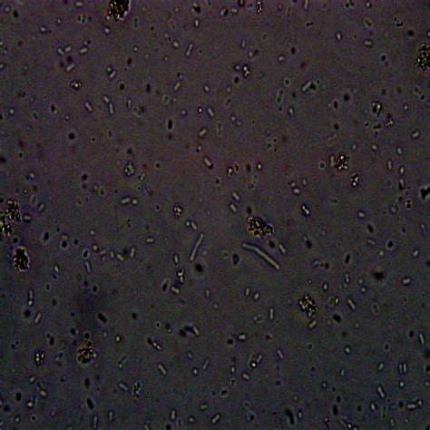 Bacterial Model Object Detection Dataset By Bacteria Classification