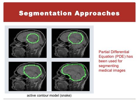 image segmentation ppt