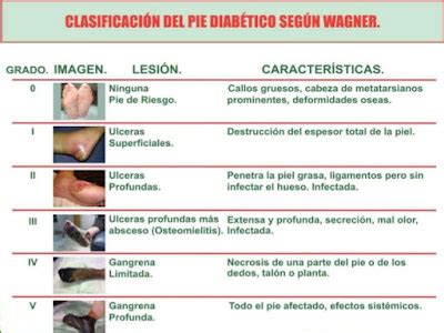 Clasificacion De Wagner Del Pie Diabetico Images 86400 Hot Sex Picture