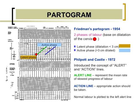 13 Partogram