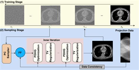 Prior Frequency Guided Diffusion Model For Limited Angle La Cbct