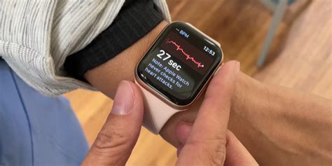 Your Health Smartwatch Records Pediatric Arrhythmia In Real Time